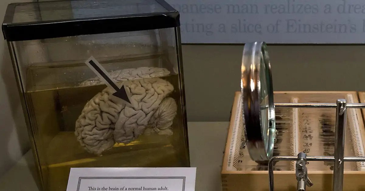 El Cerebro De Albert Einstein En Un Frasco